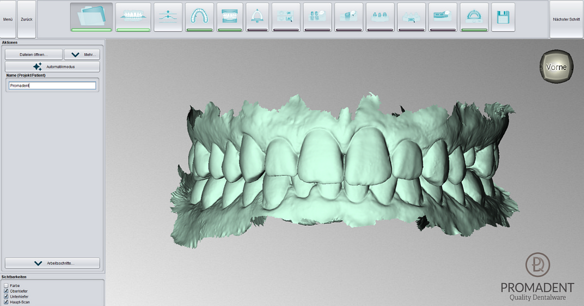 Promadent-Software „Biss“ goes international | zahntechnikzentrum.info