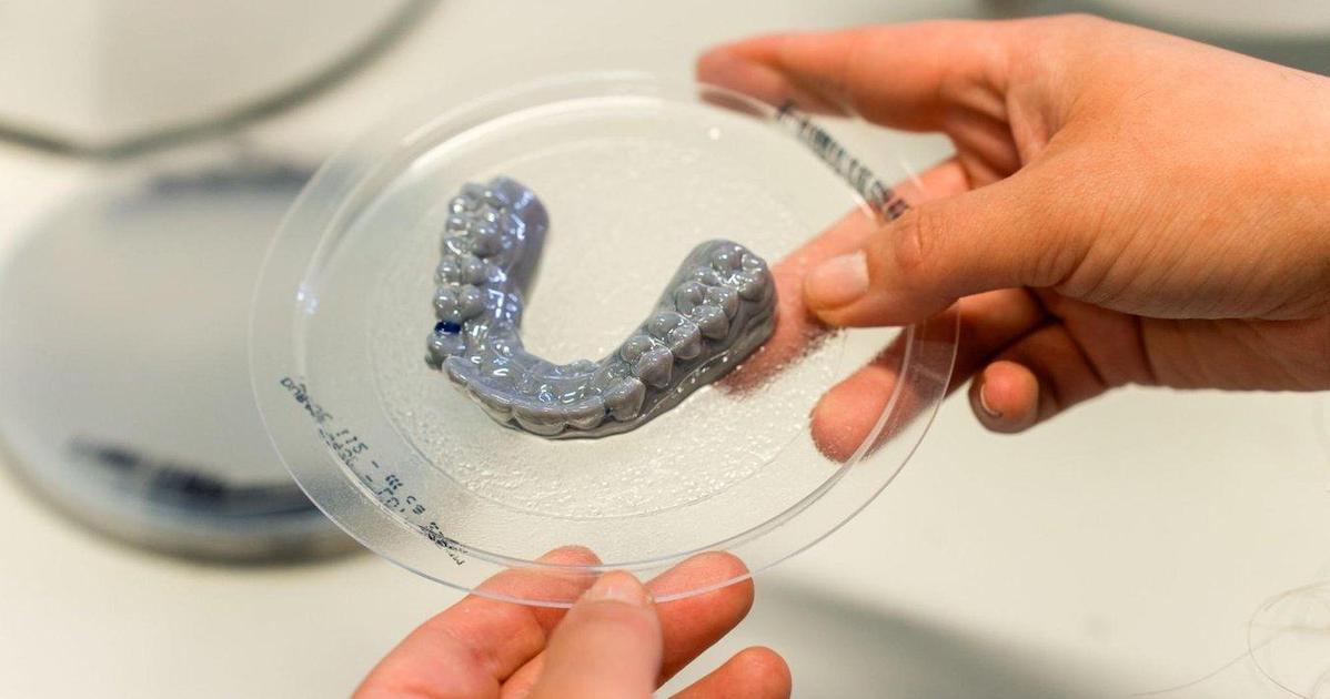 Einfache Aligner-Herstellung mittels 3D-Druck - zahntechnikzentrum.info